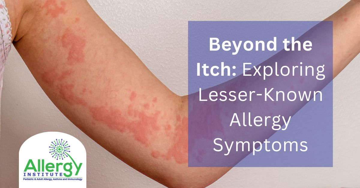 Hidden Allergy Symptoms: Beyond the Itch